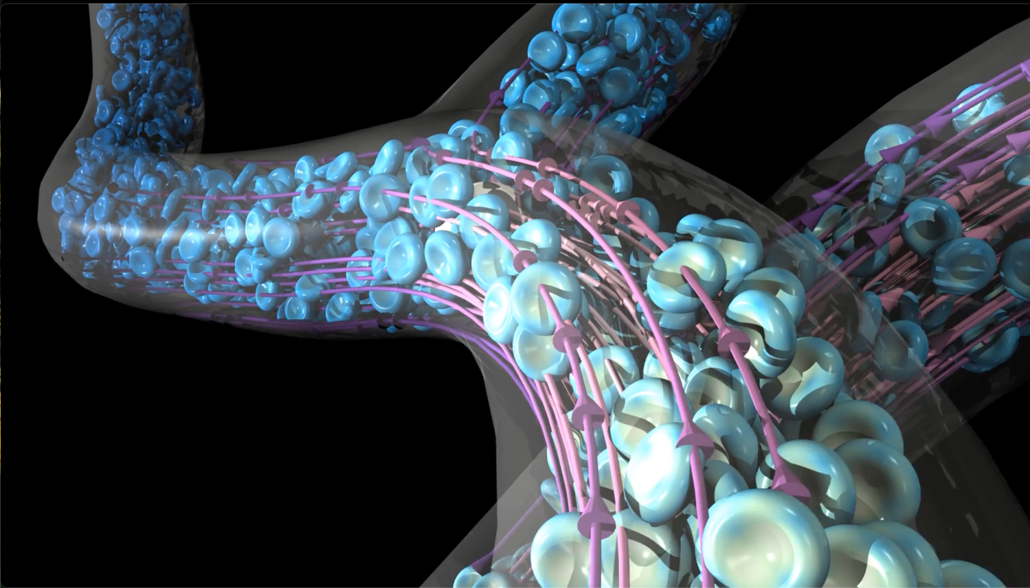 Amanda Randles: A Check-Engine Light for the Heart - Science in Parallel